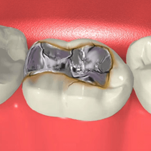 Emergency Dentist Midland Texas| Dental Emergency Midland